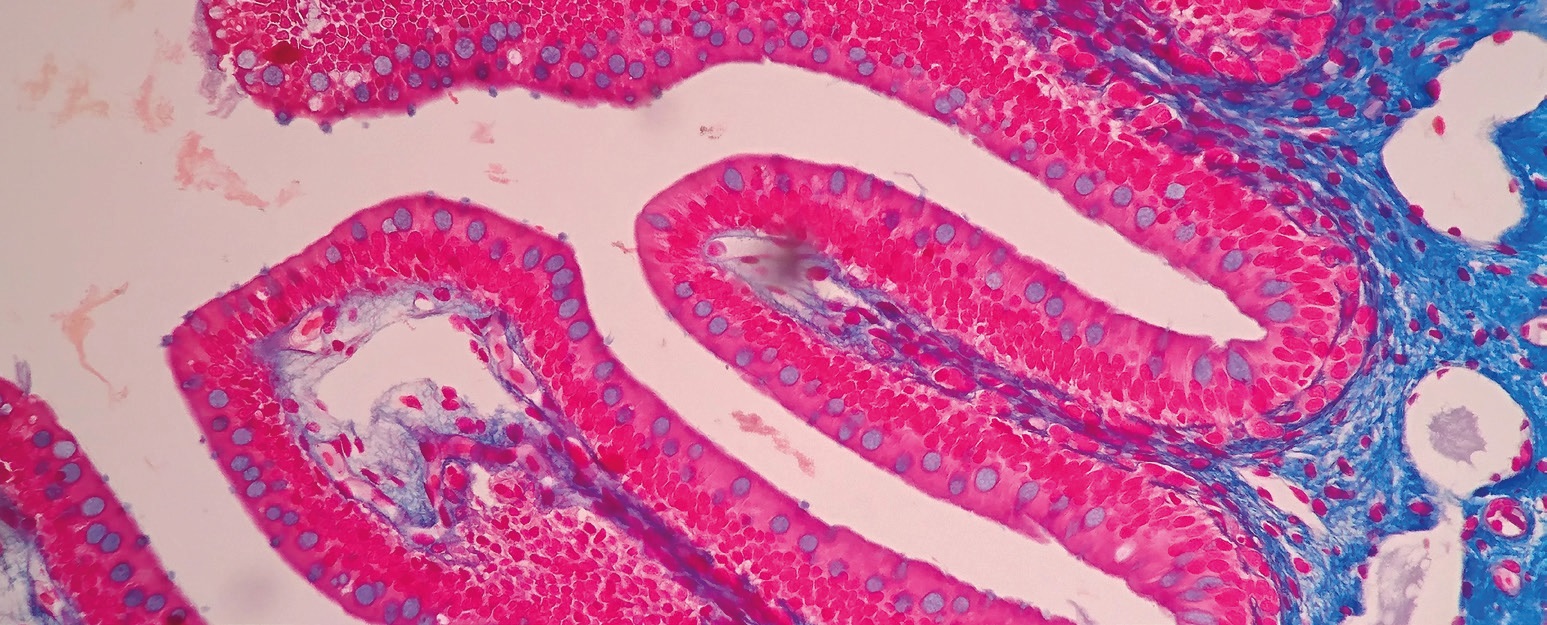 Prevalencia de deoxinivalenol y fumonisina B1 en alimentos de aves y ...